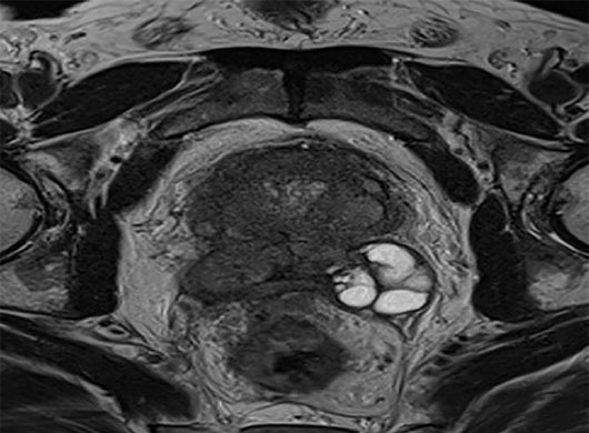 Ογκολογικός Ασθενής | ΒΙΟΤΥΠΟΣ